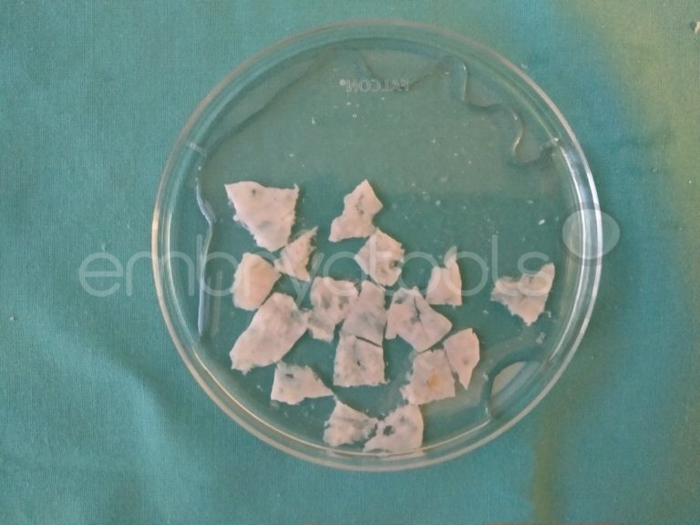 06 - Ovarian Tissue Cryopreservation - Embryotools
