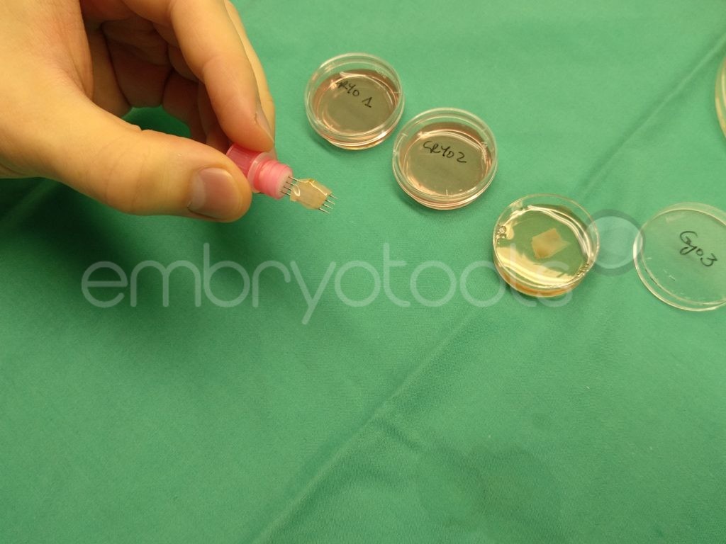 06 - Ovarian Tissue Cryopreservation - Embryotools